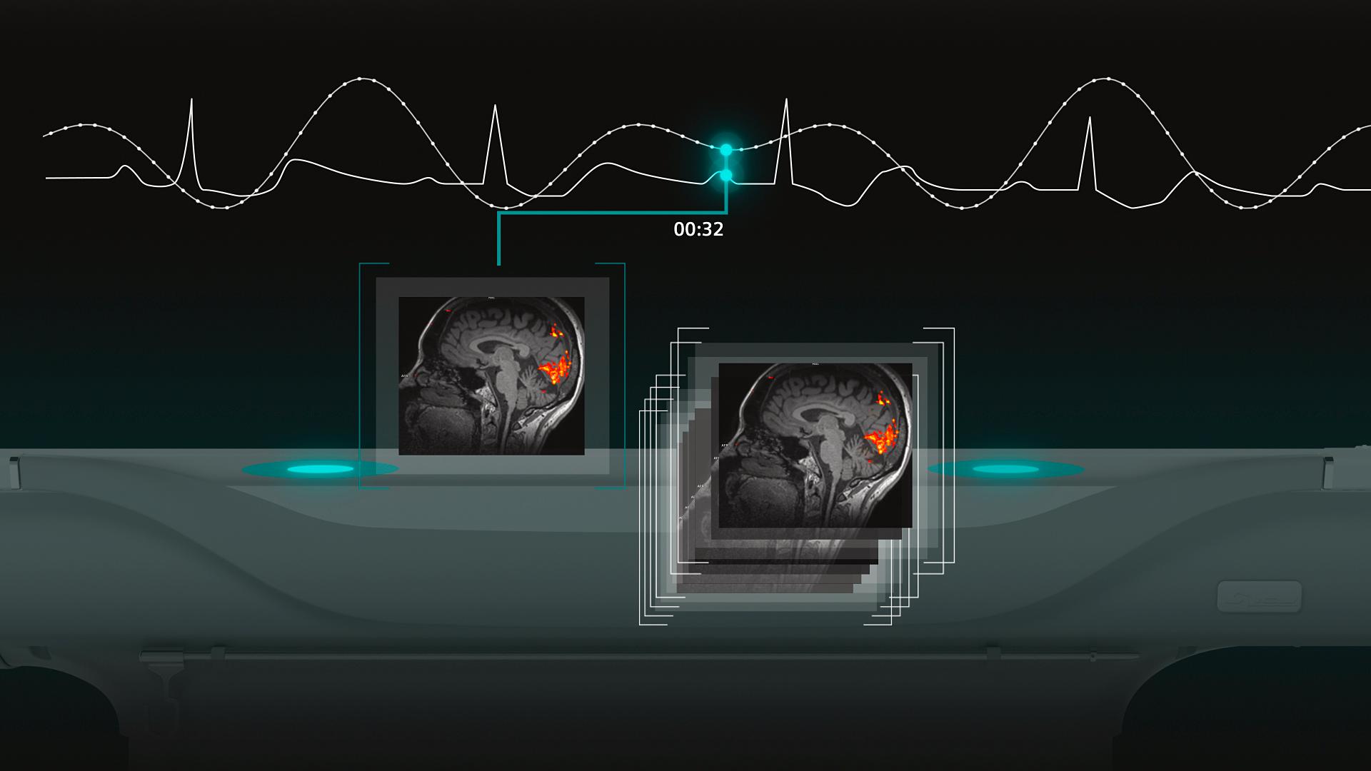 MAGNETOM Cima.X – Machen Sie den Unterschied – Siemens Healthineers ...