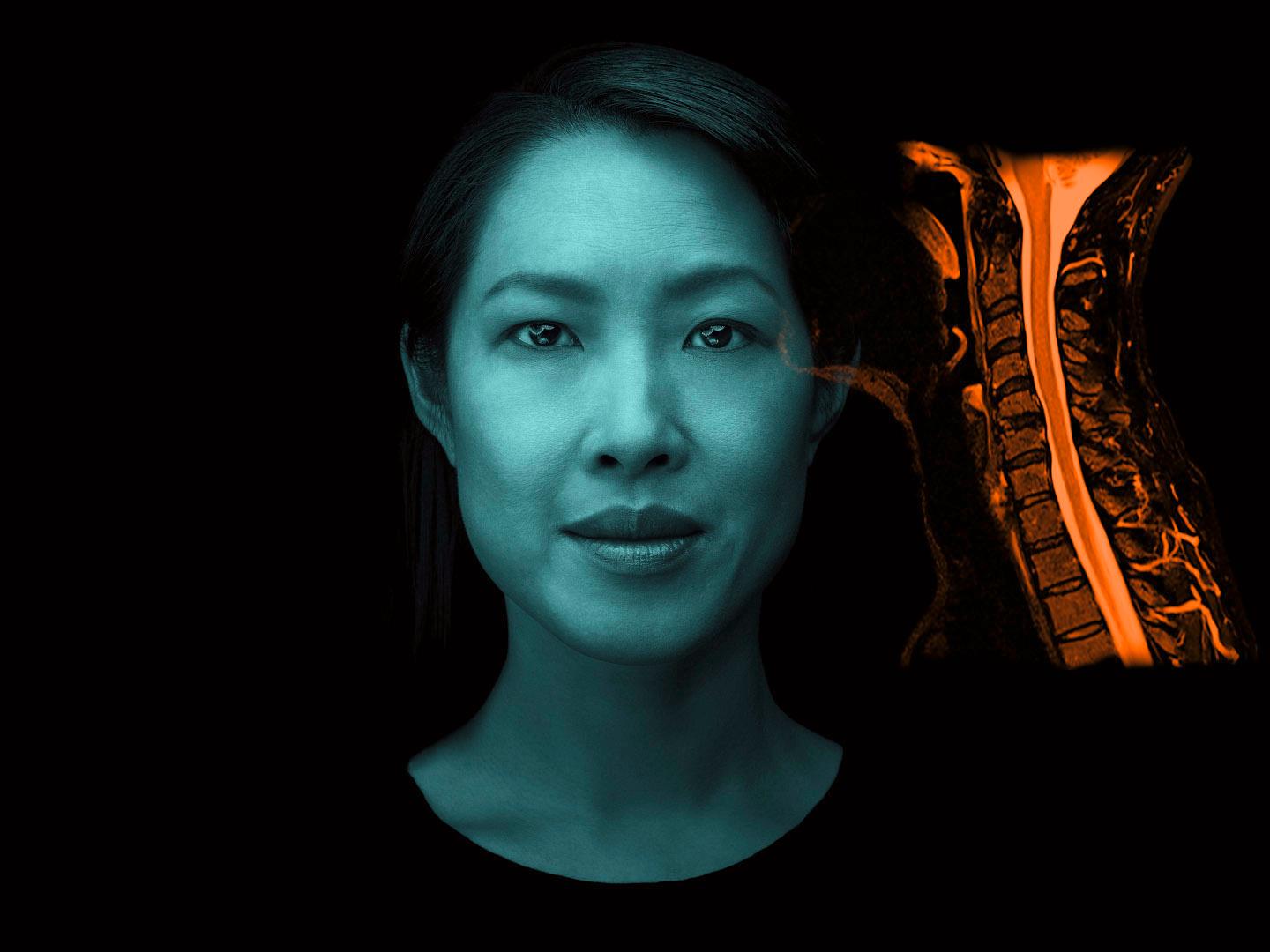 Tecnologia BioMatrix - Siemens Healthineers Brasil