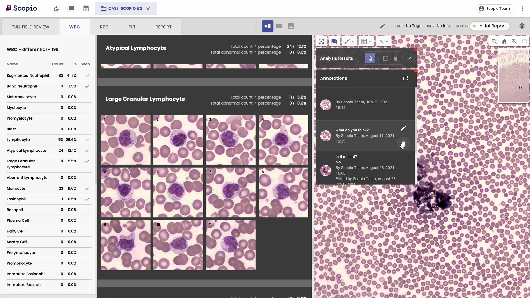 Scopio Full-field Digital Cell Morphology - Siemens Healthineers USA