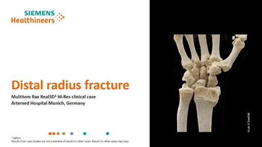 Robotic X-Ray - Clinical Case Library - Siemens Healthineers