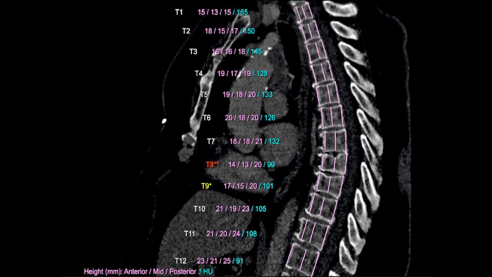 Computed Tomography - Siemens Healthineers