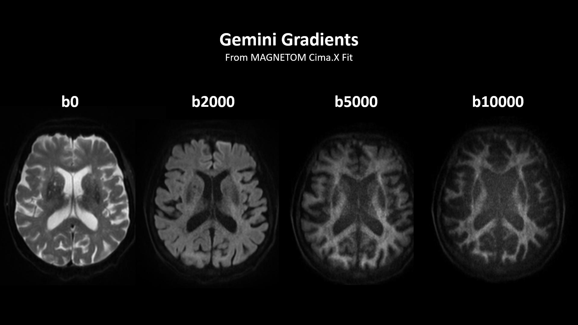 MAGNETOM Cima.X Fit - Siemens Healthineers