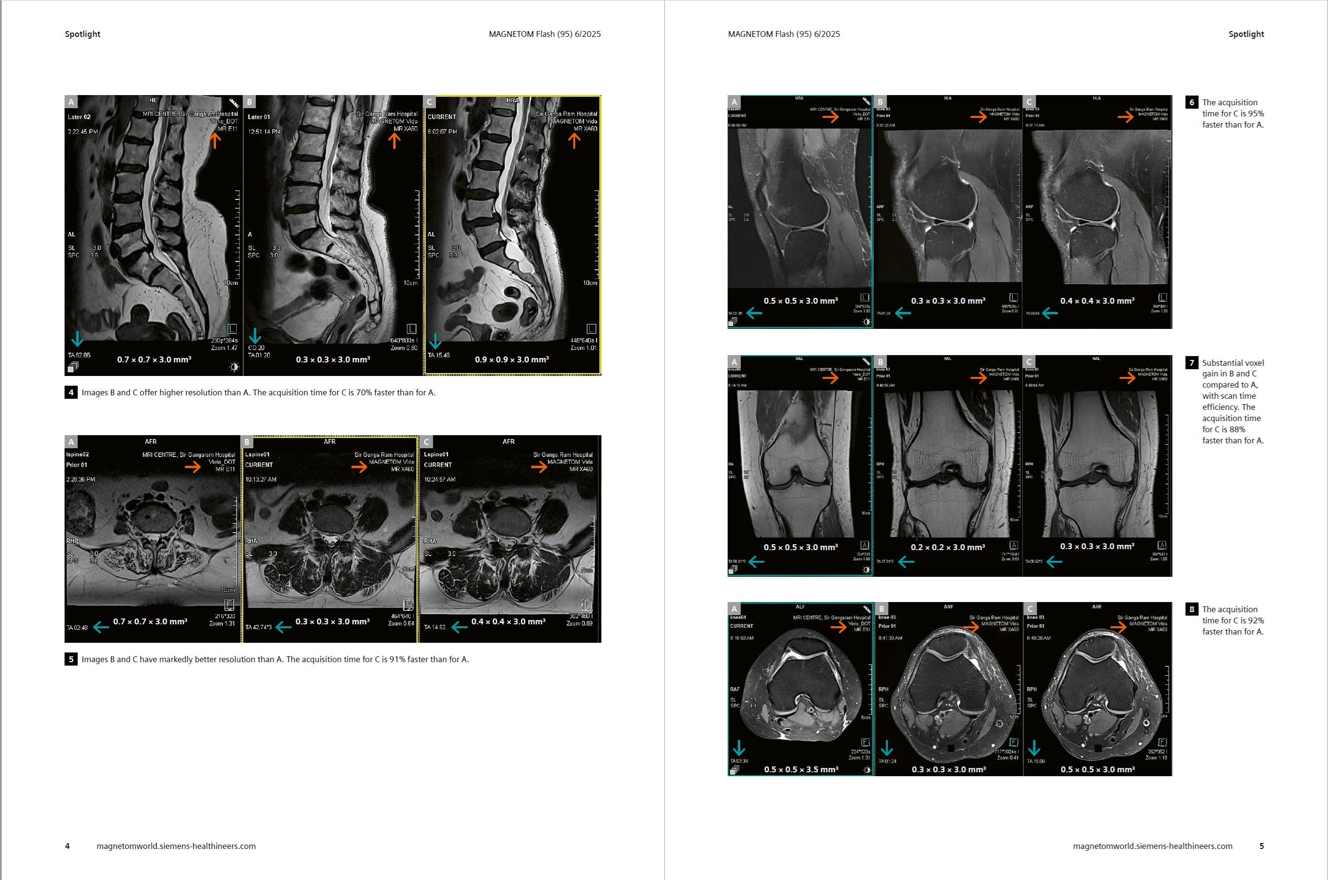 From Routine to Rapid: Two-Minute Deep-Learning-Enabled Protocols