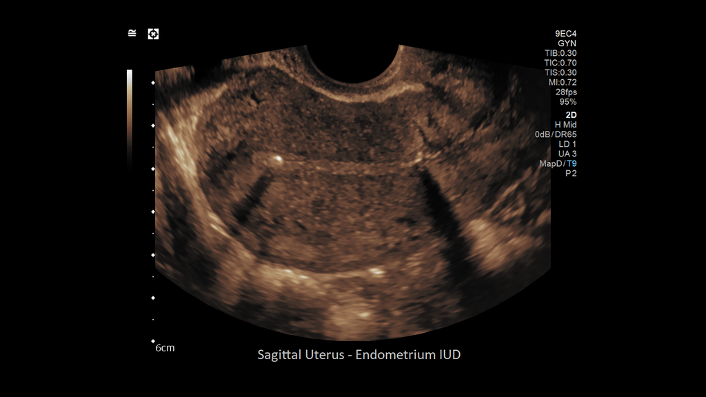 ACUSON Sequoia Ultrasound System - Siemens Healthineers