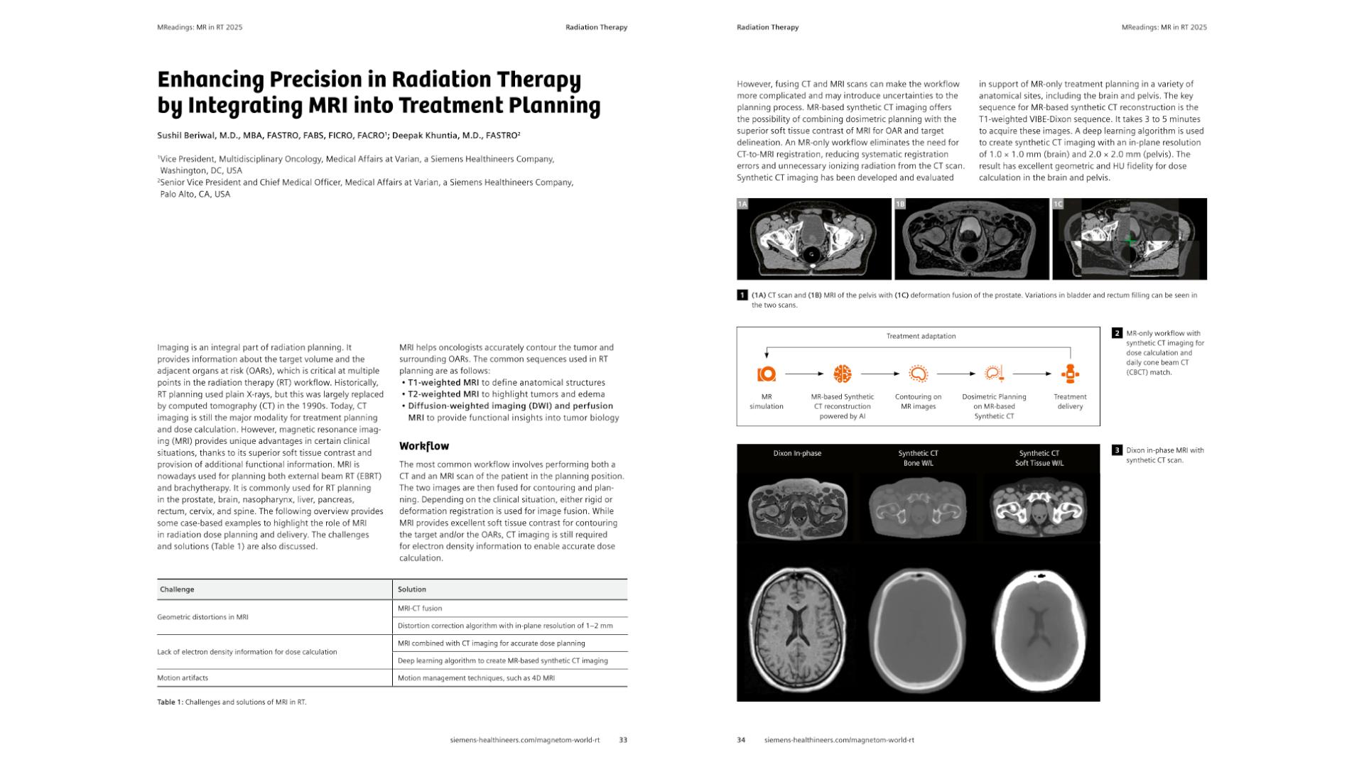 MRI for radiation therapy - Siemens Healthineers