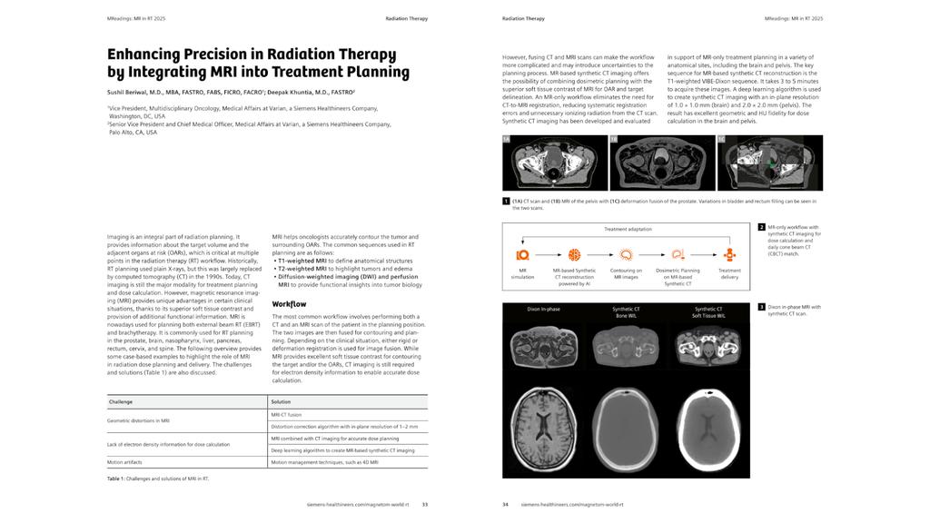 MRI for radiation therapy - Siemens Healthineers