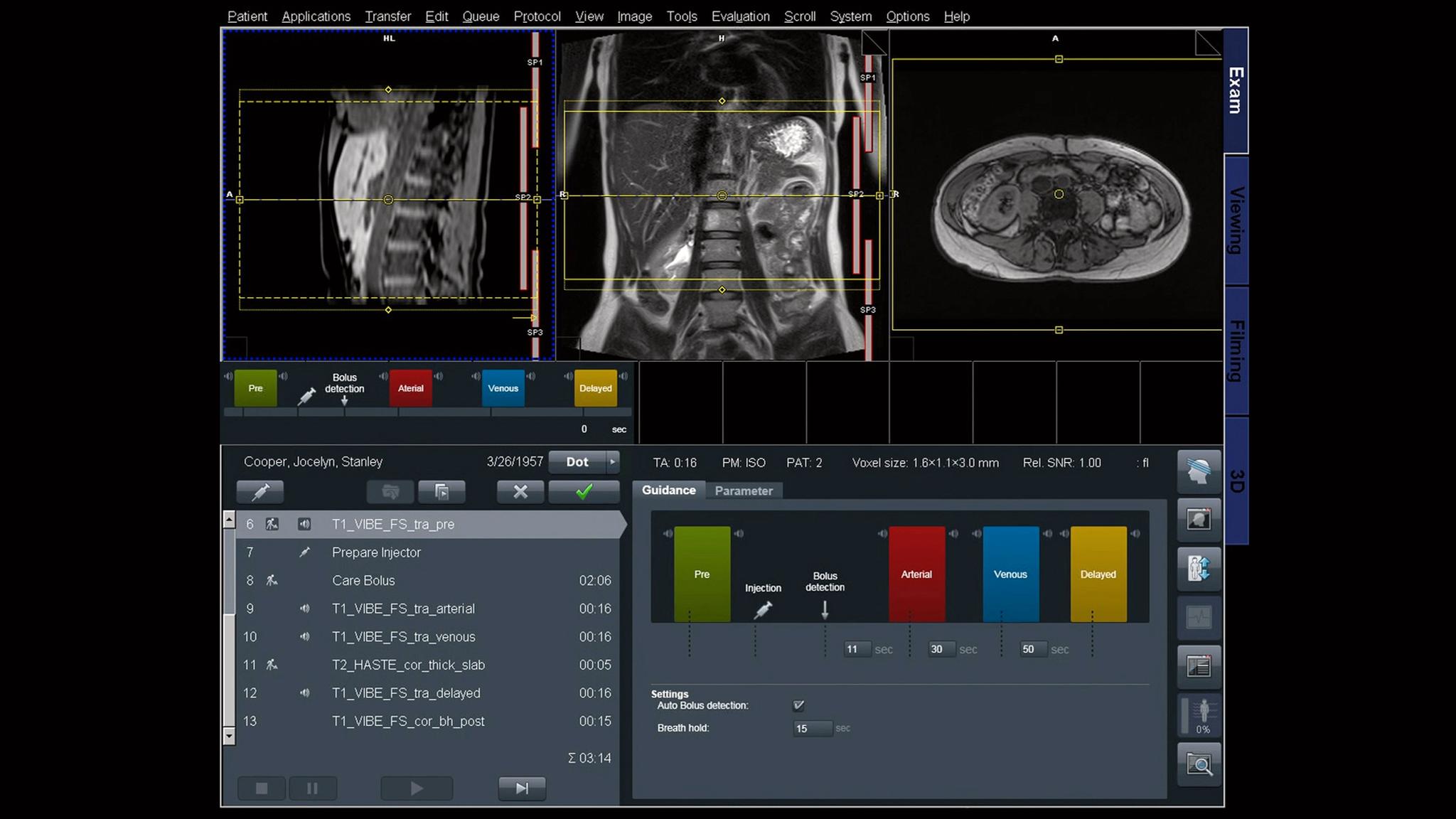 Abdomen Dot Engine - Siemens Healthineers USA