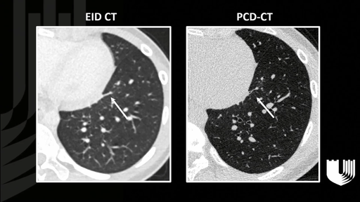 Computed Tomography Scientific Presentations - Siemens Healthineers USA