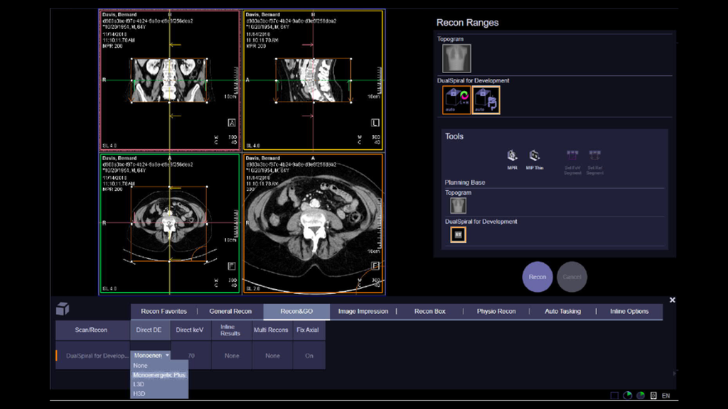 Dual Energy CT Spectral Imaging - Siemens Healthineers USA