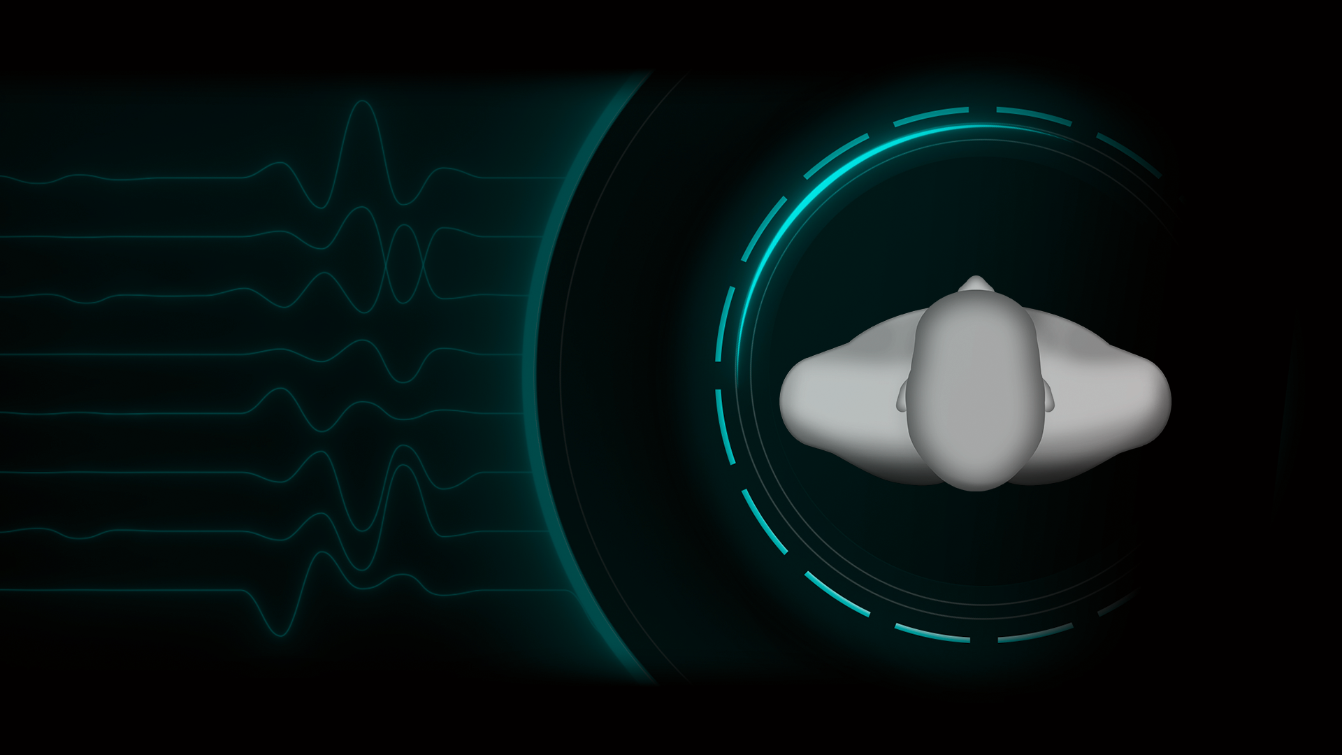 MAGNETOM Terra.X – Machen Sie den Unterschied – Siemens Healthineers ...