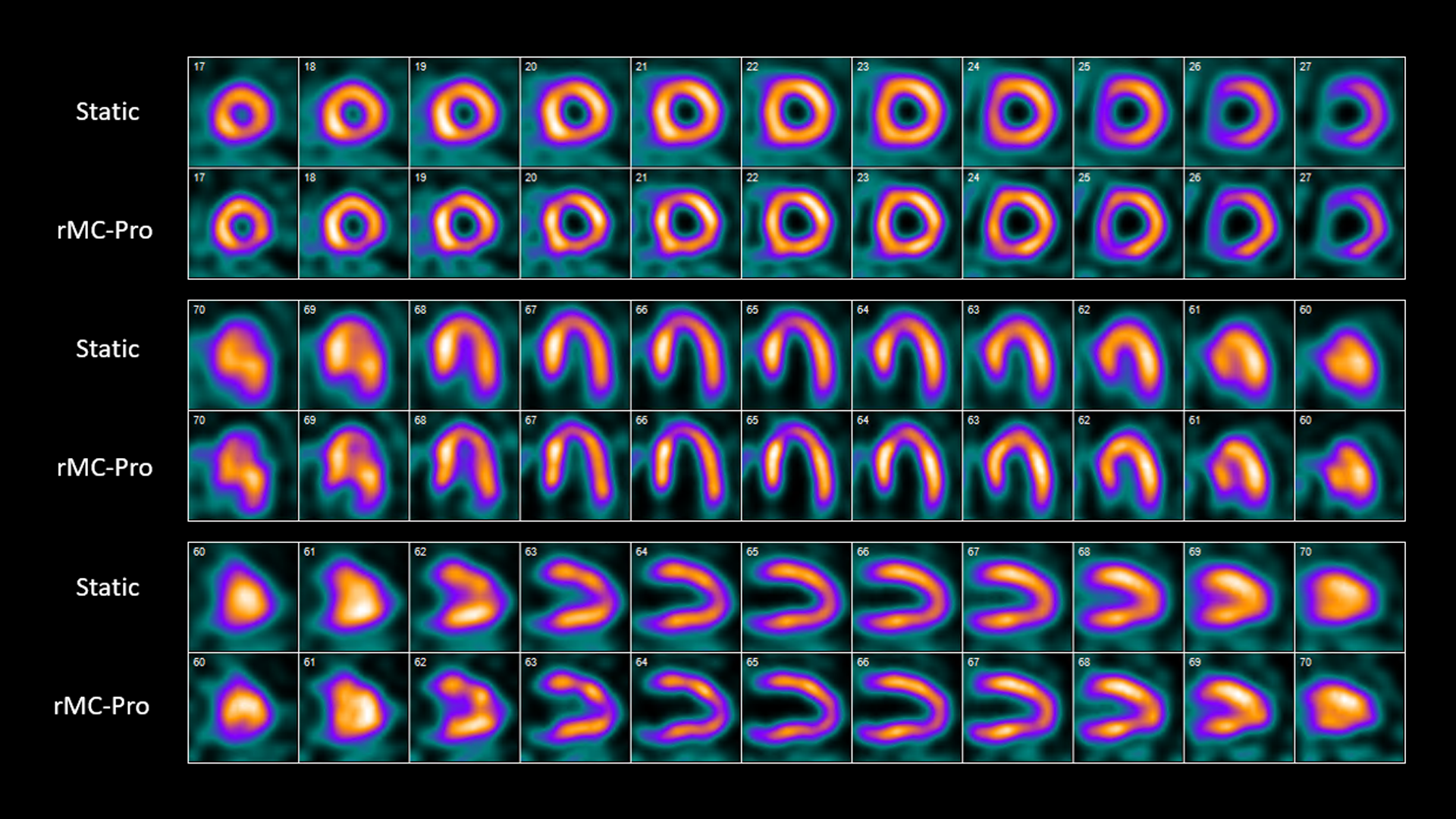 Symbia Pro.specta SPECT/CT - Siemens Healthineers Canada