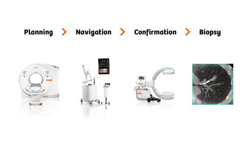 Image-guided robotic bronchoscopy - Siemens Healthineers USA