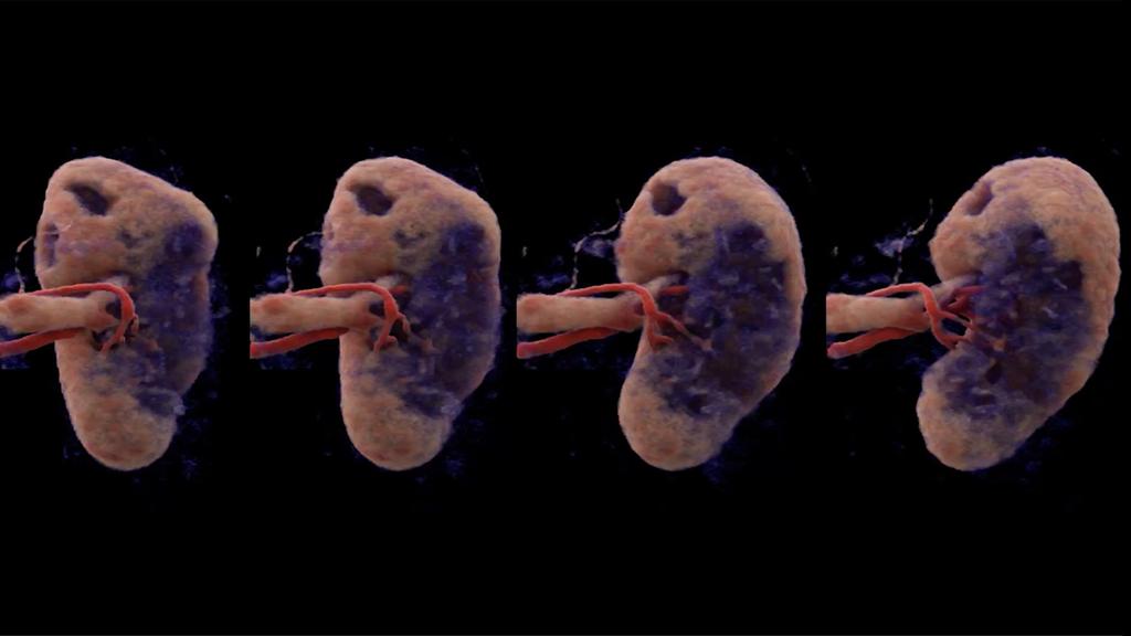 PCCT scientific evidence - Siemens Healthineers