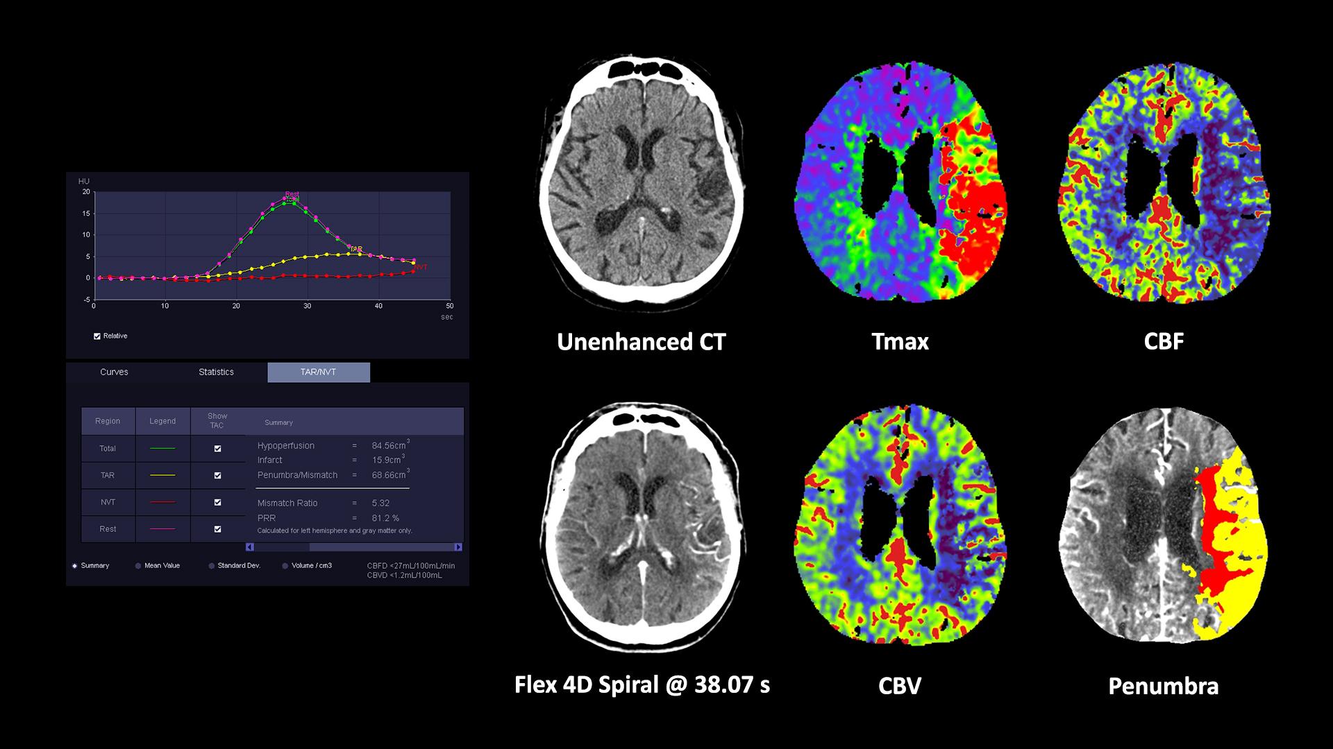 SOMATOM X.cite mit myExam Companion – Siemens Healthineers Deutschland