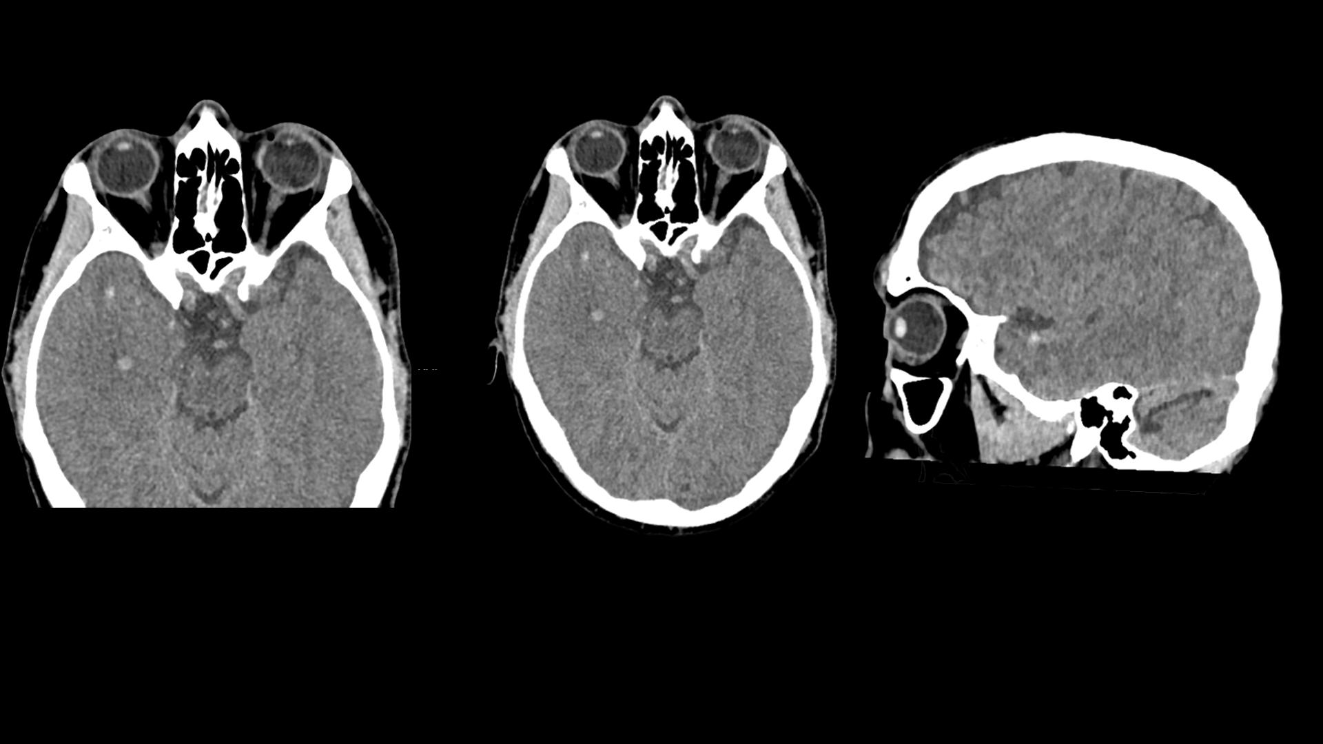 SOMATOM On.site - Siemens Healthineers USA