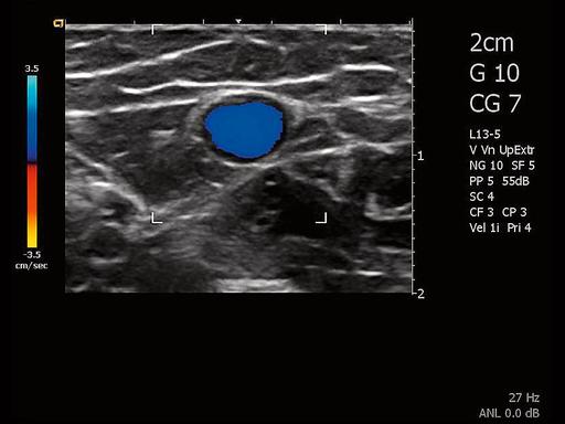 Wireless Ultrasound System | ACUSON Freestyle - Siemens Healthineers USA