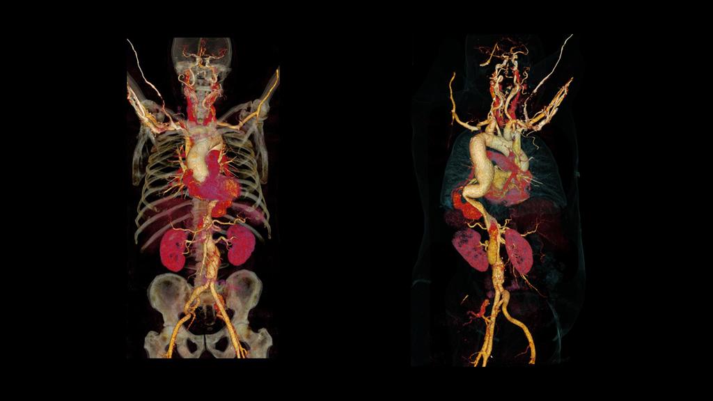 SOMATOM Drive eco – CT Scanner - Siemens Healthineers