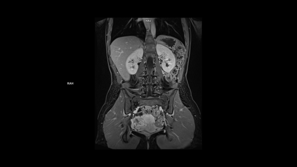 MAGNETOM Prisma - MRI Scanner - Siemens Healthineers