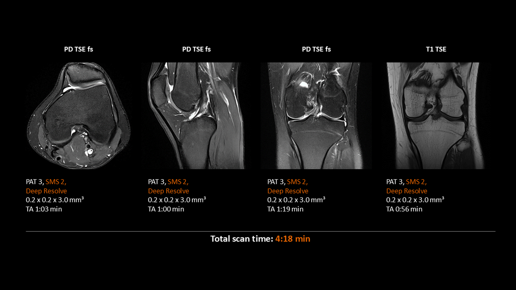 MAGNETOM Altea 新時代に求められる生産性と再現性 - Siemens Healthineers Japan