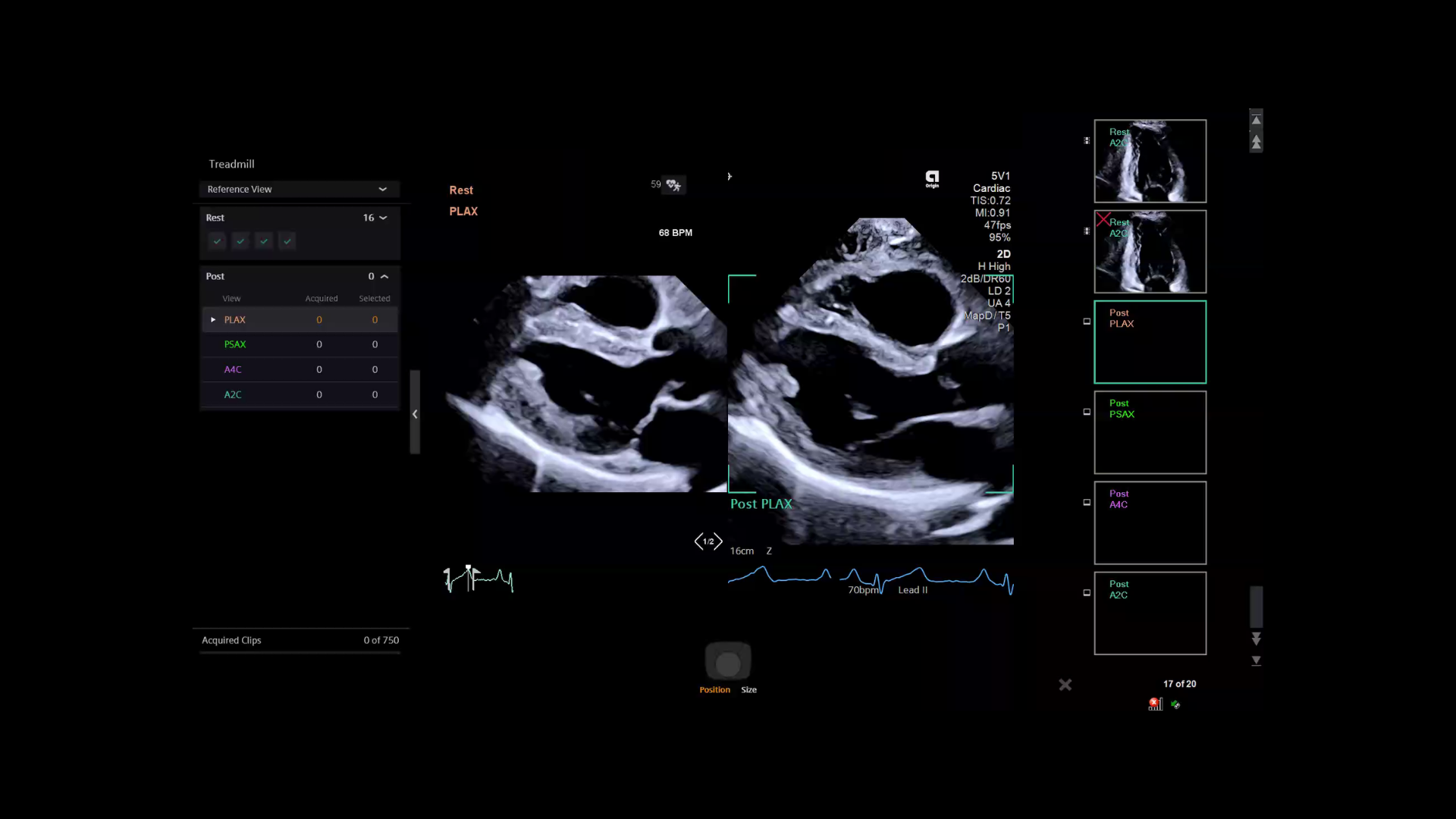 ACUSON Origin Cardiovascular Ultrasound System - Siemens Healthineers USA