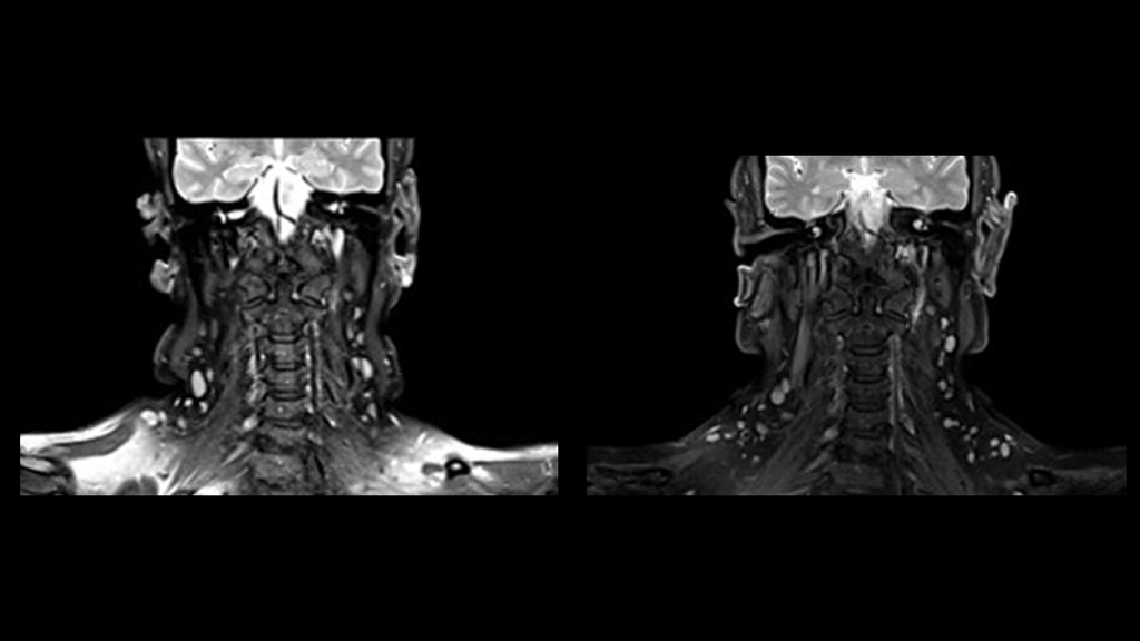 BioMatrix Technology - Siemens Healthineers