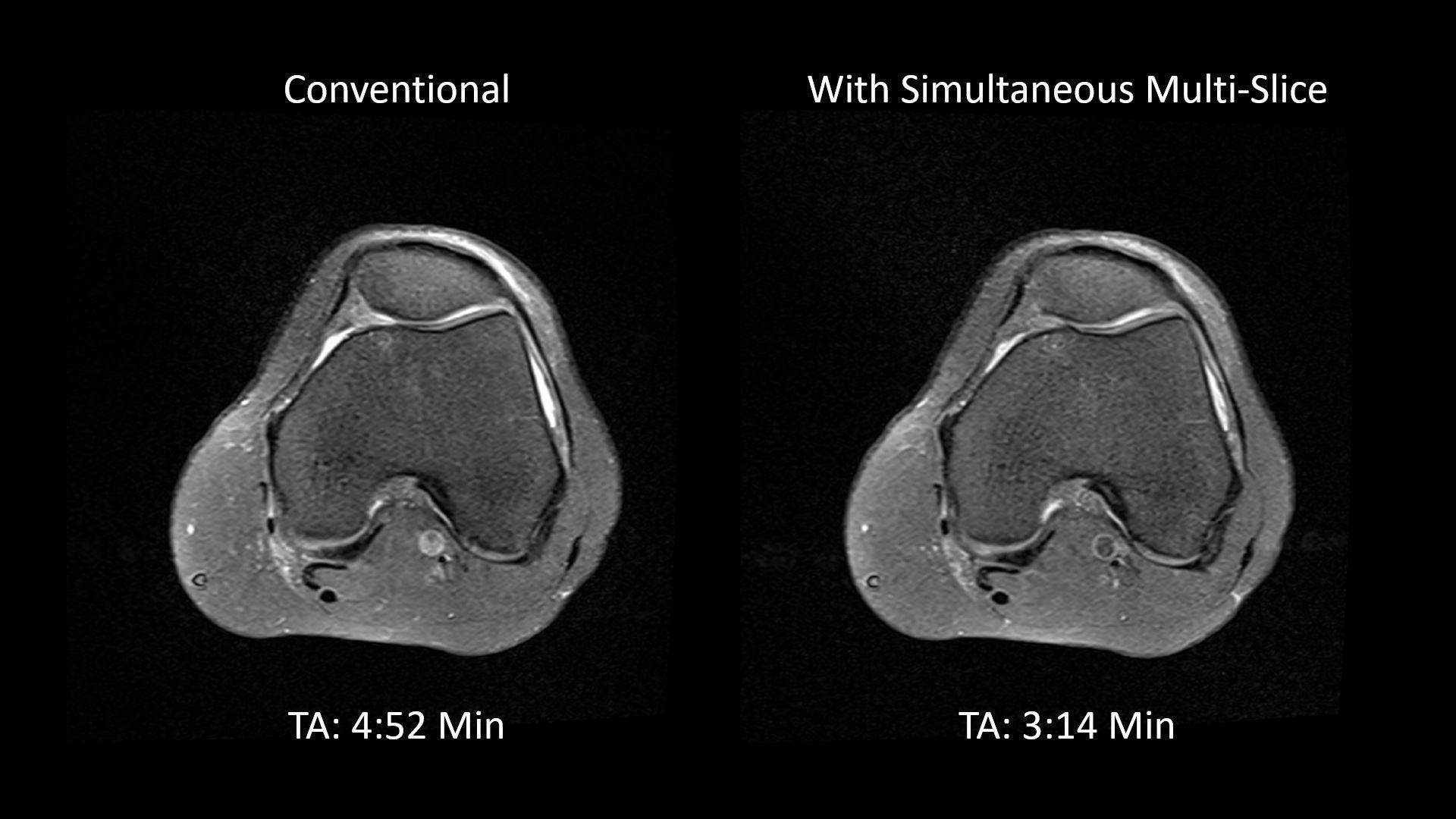 MAGNETOM Free.Max – Open Bore MRI - Siemens Healthineers USA