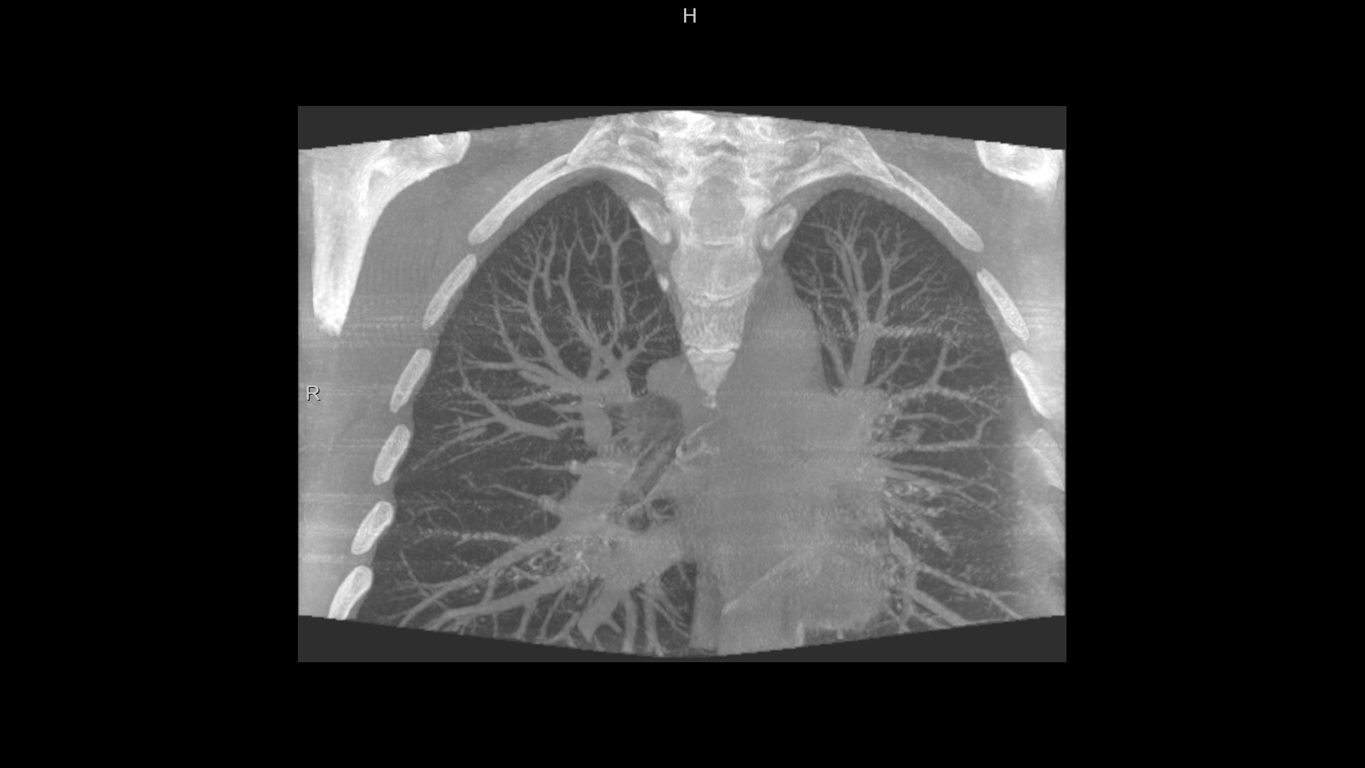 syngo DynaCT - Siemens Healthineers USA