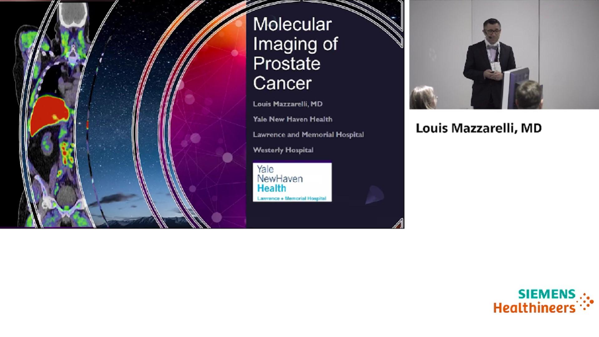 Molecular imaging in prostate cancer - Siemens Healthineers