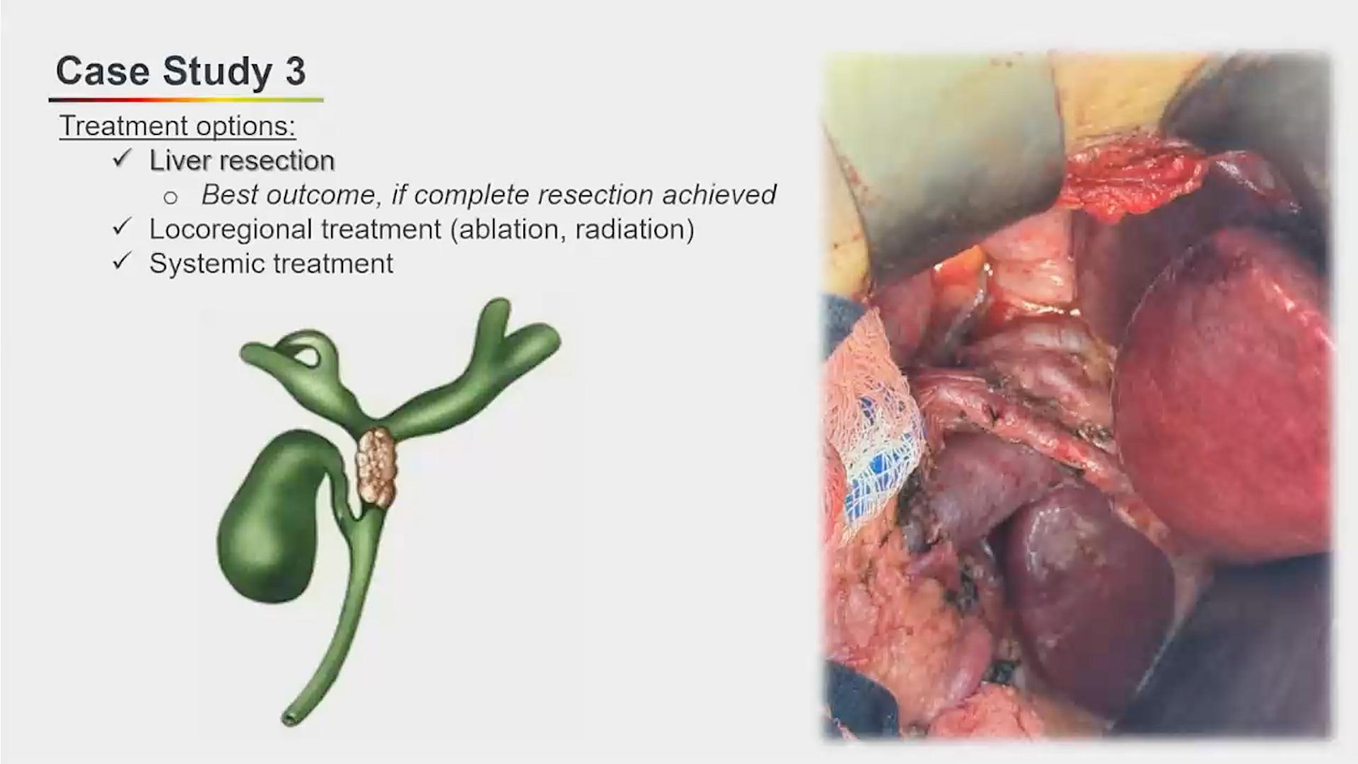 PCCT scientific evidence - Siemens Healthineers