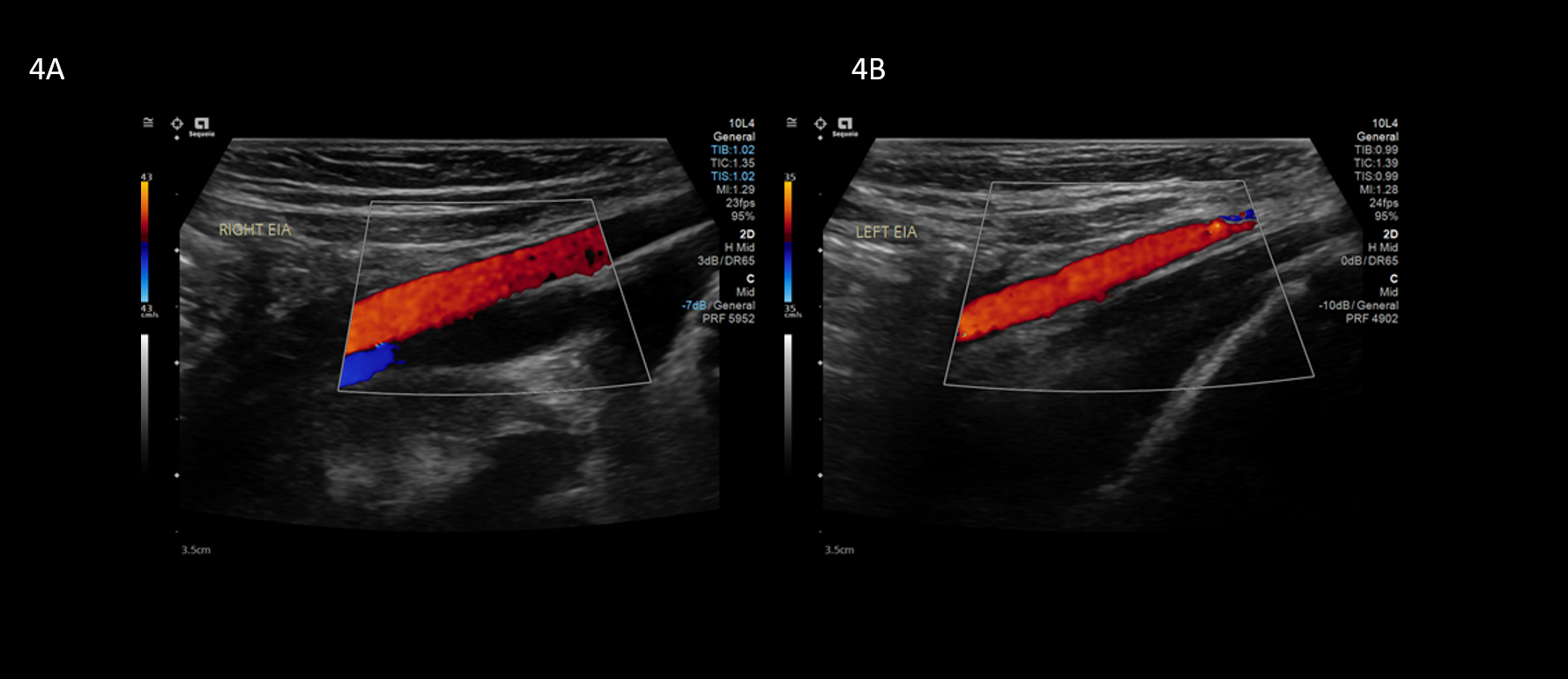 New Technologies help in Rare Ultrasound Case Studies