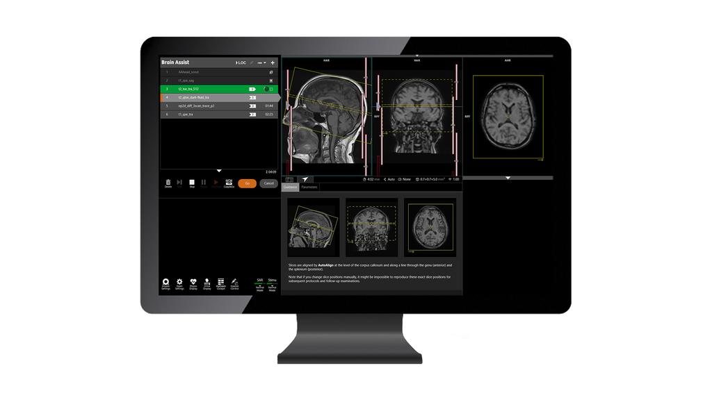 MAGNETOM Cima.X - Make the difference. - Siemens Healthineers USA