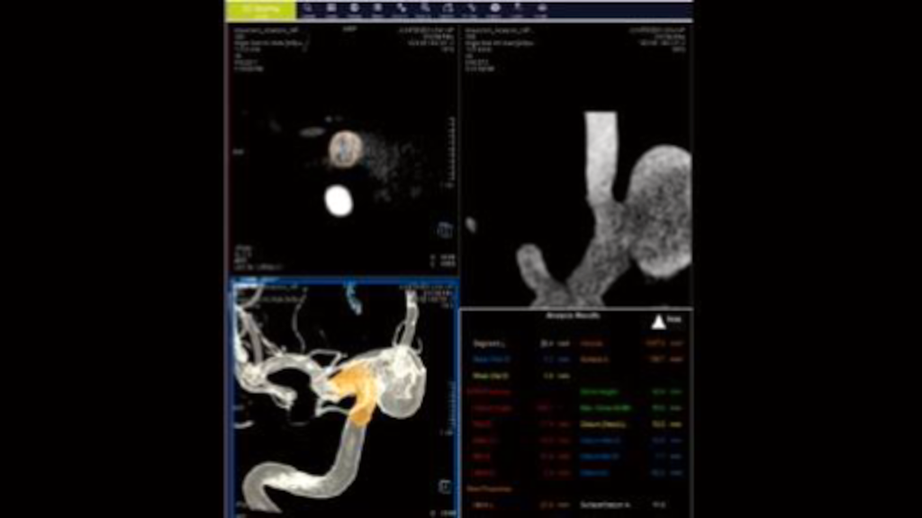 ExpertGuidance - Siemens Healthineers