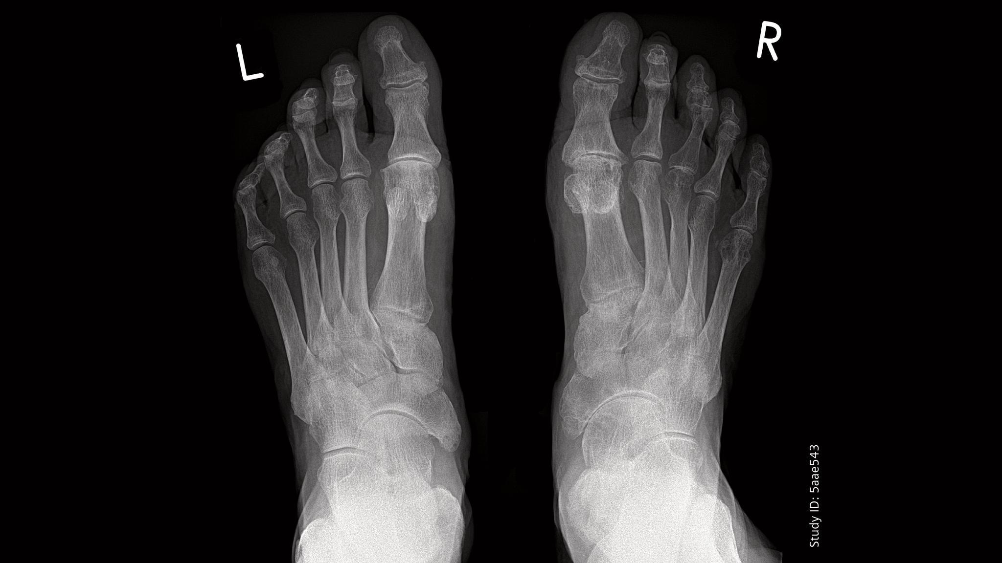MOBILETT Impact - Siemens Healthineers