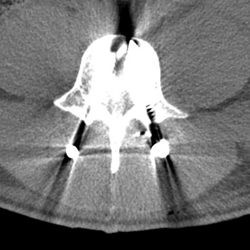 iMAR - Siemens Healthineers