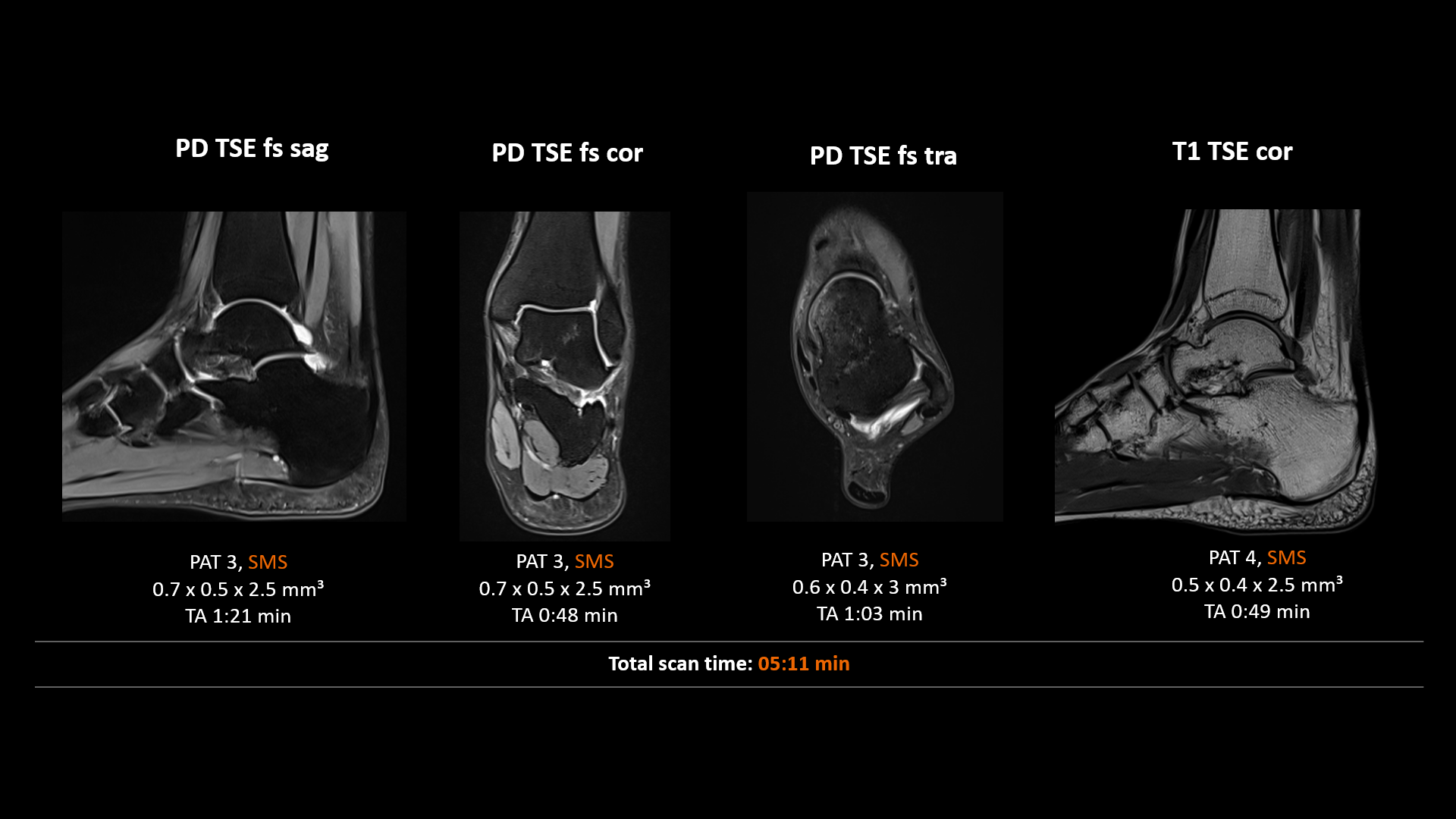 Musculoskeletal Imaging - Siemens Healthineers