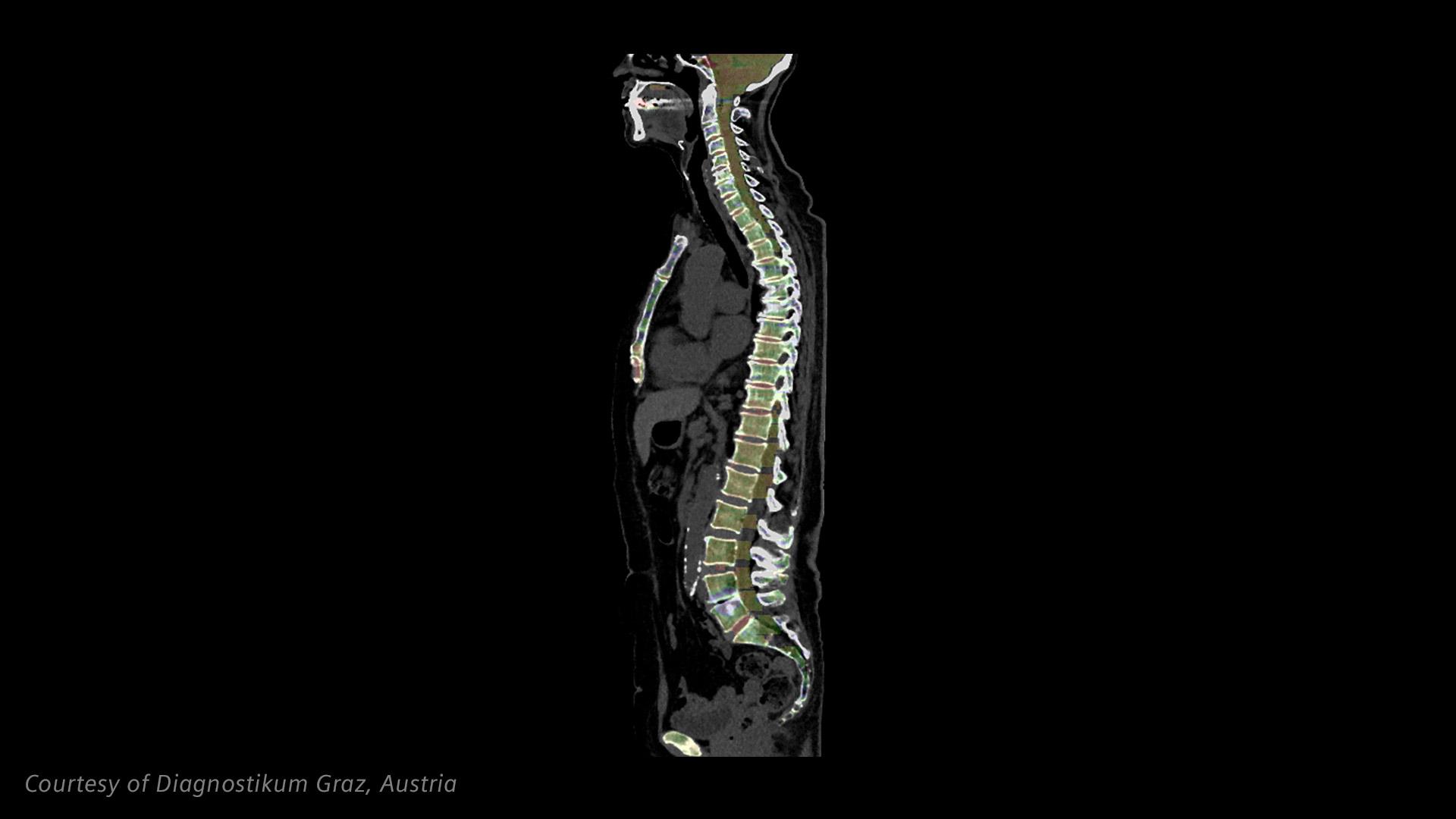 NAEOTOM Alpha.Pro - Siemens Healthineers