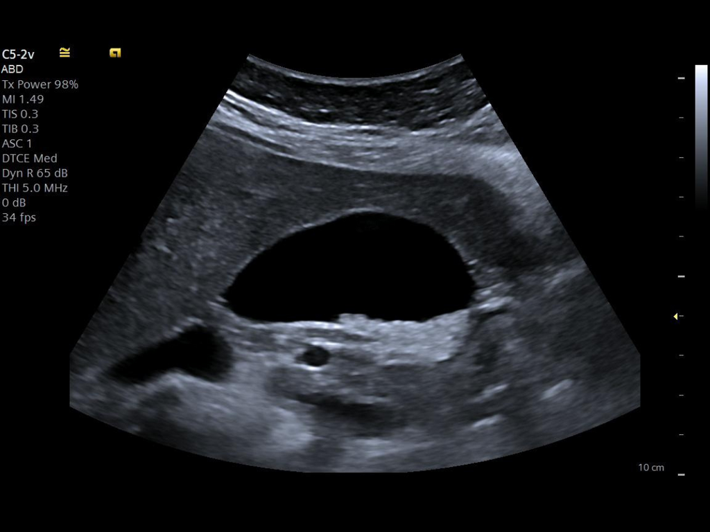 ACUSON Maple is a High-Performance Shared Service Ultrasound System ...