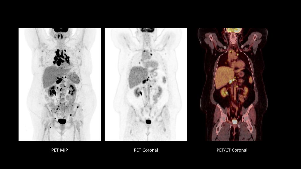 Biograph Trinion PET/CT scanner - Siemens Healthineers Japan