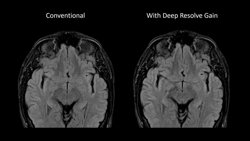 MAGNETOM Free.Max – Open Bore MRI - Siemens Healthineers USA