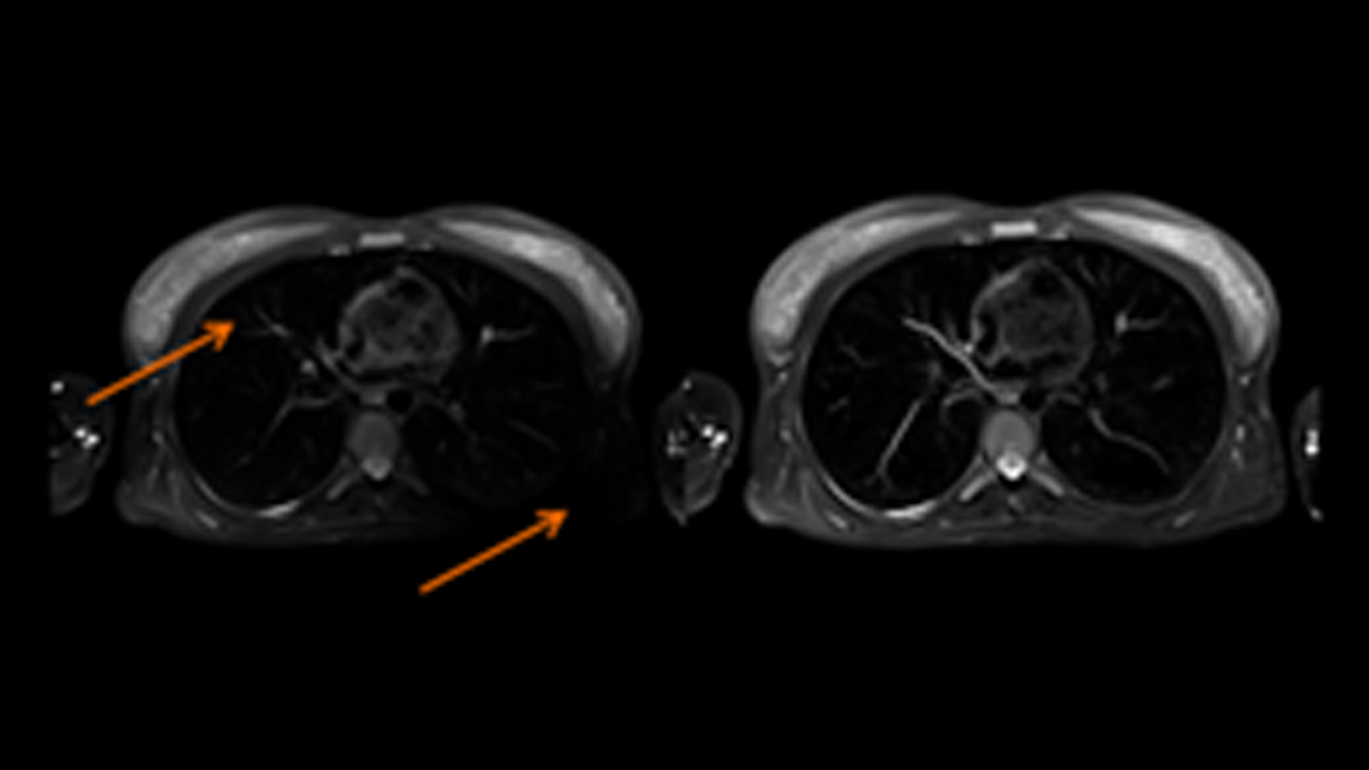 BioMatrix Technology - Siemens Healthineers