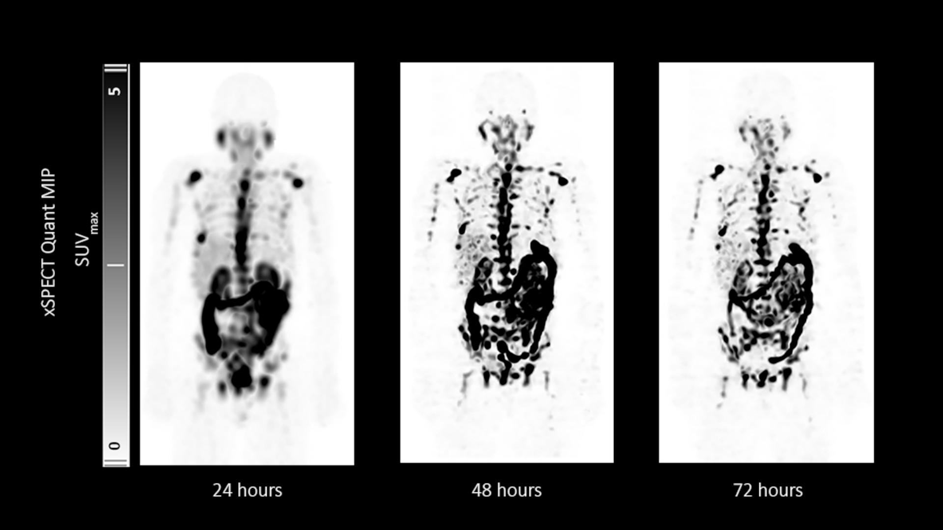 Symbia Pro.specta SPECT/CT Fast imaging - Siemens Healthineers