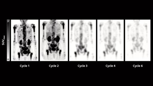 Fast, quantitative SPECT/CT acquisition following multiple therapy ...