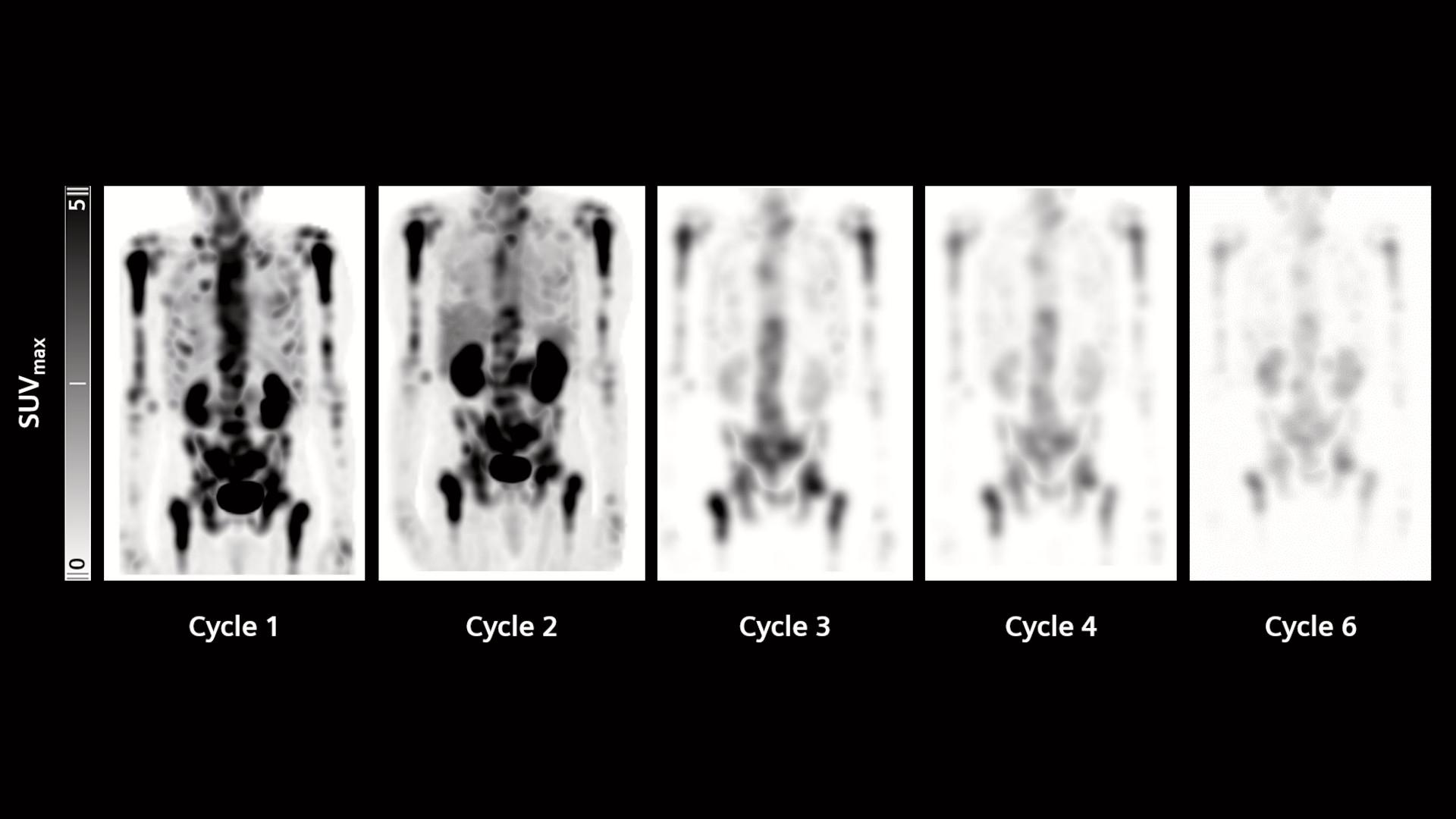 Fast, quantitative SPECT/CT acquisition following multiple therapy ...