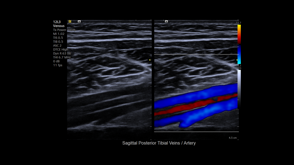 ACUSON Juniper, CV Edition Ultrasound System - Siemens Healthineers