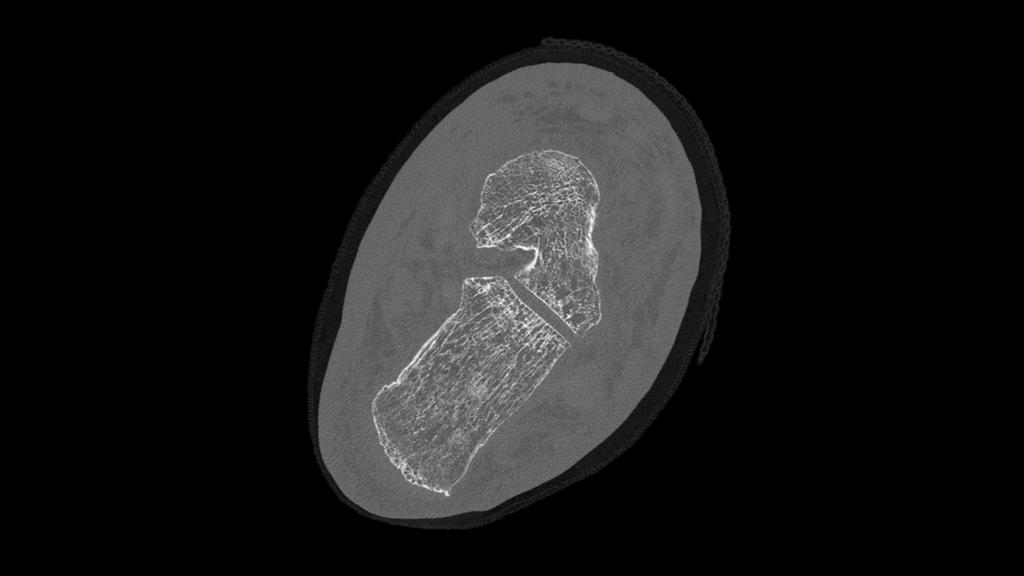 The NAEOTOM Alpha class - Siemens Healthineers