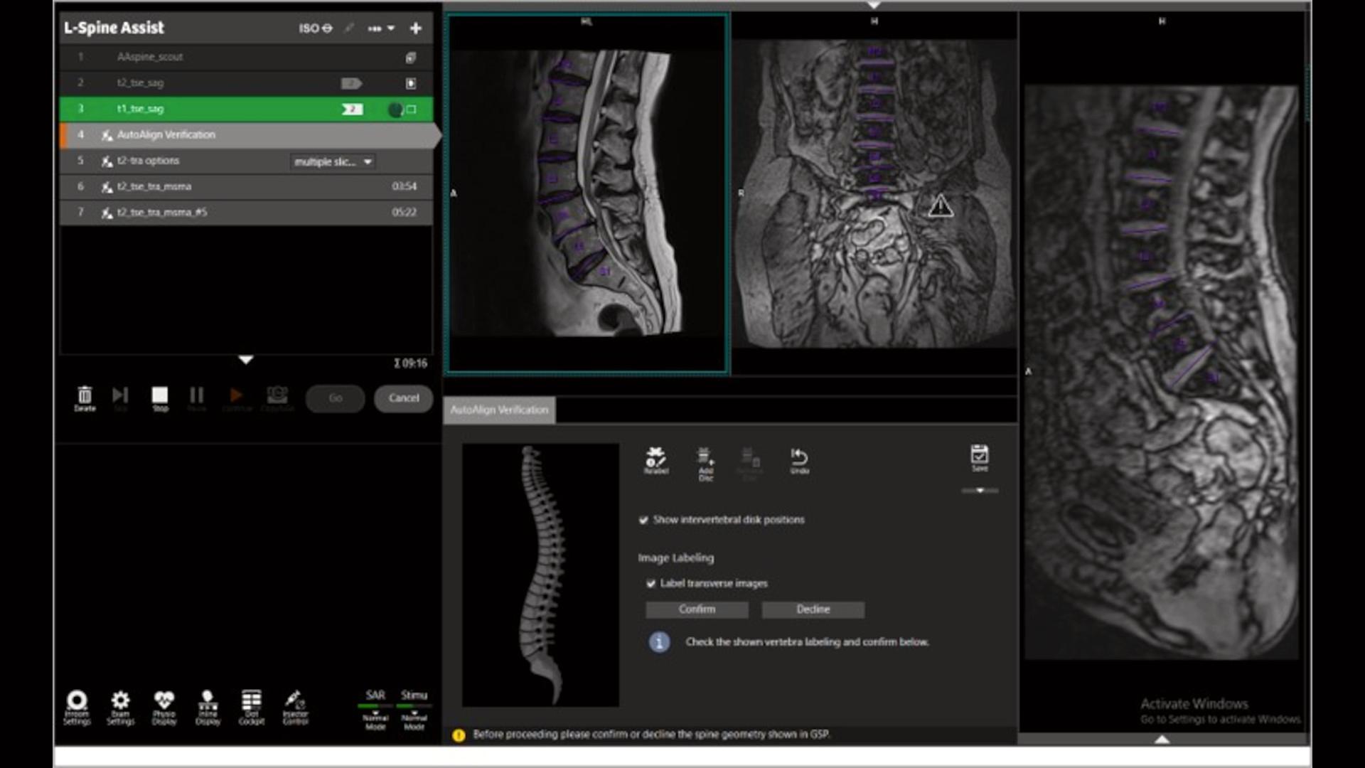 Musculoskeletal Imaging - Siemens Healthineers