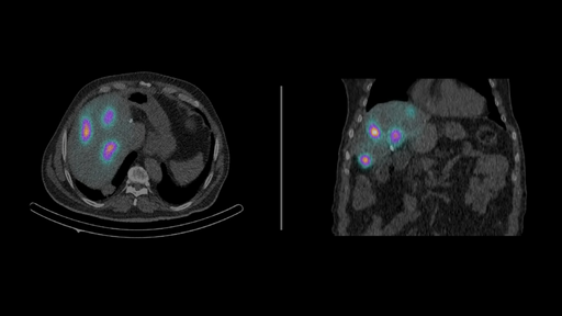 Unlocking new clinical possibilities: the versatility of SPECT/CT ...