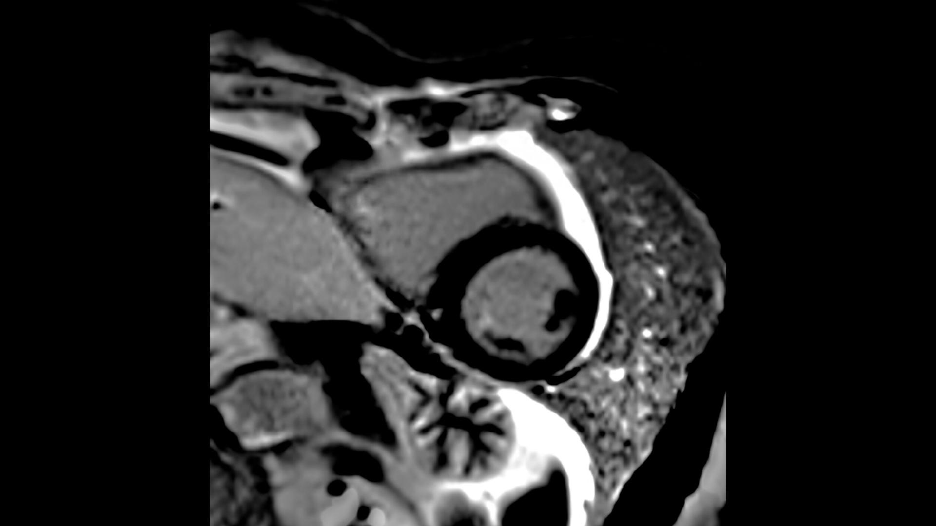 Phoenix Images for MAGNETOM Sola 1.5T