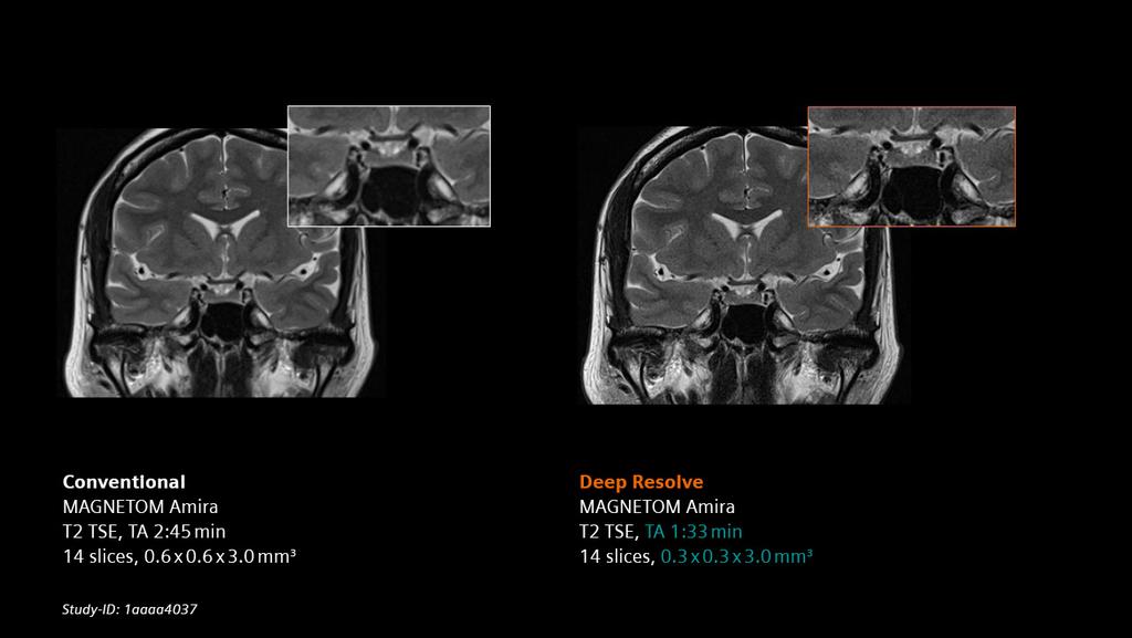 Deep Resolve – Siemens Healthineers Deutschland