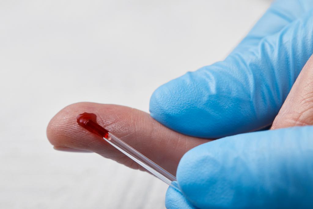 Preanalytical sampling devices - Siemens Healthineers USA